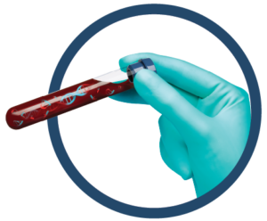 Pre-Treatment - NavDx