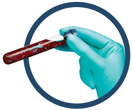 Pre-Treatment - NavDx